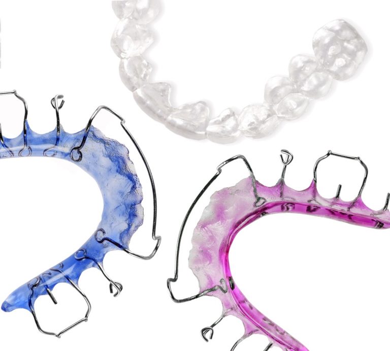 Retainers After Orthodontic Treatment | American Association of ...
