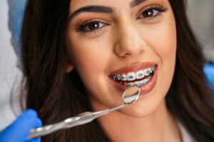 How Do Braces Work? | American Association of Orthodontists