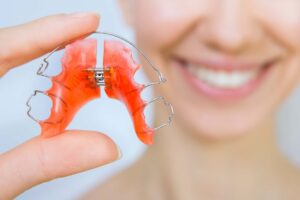 Retainers After Orthodontic Treatment | American Association of ...