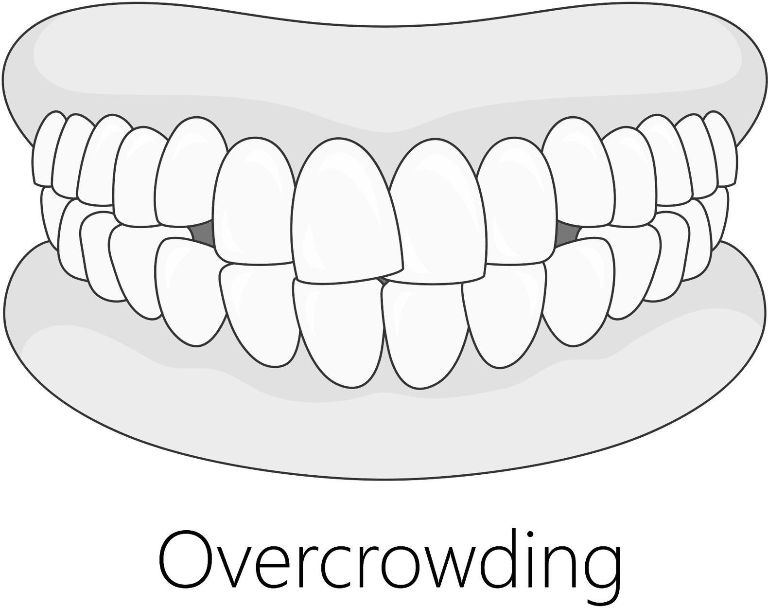 Adult Orthodontics: Smile with Confidence at Any Age | American ...