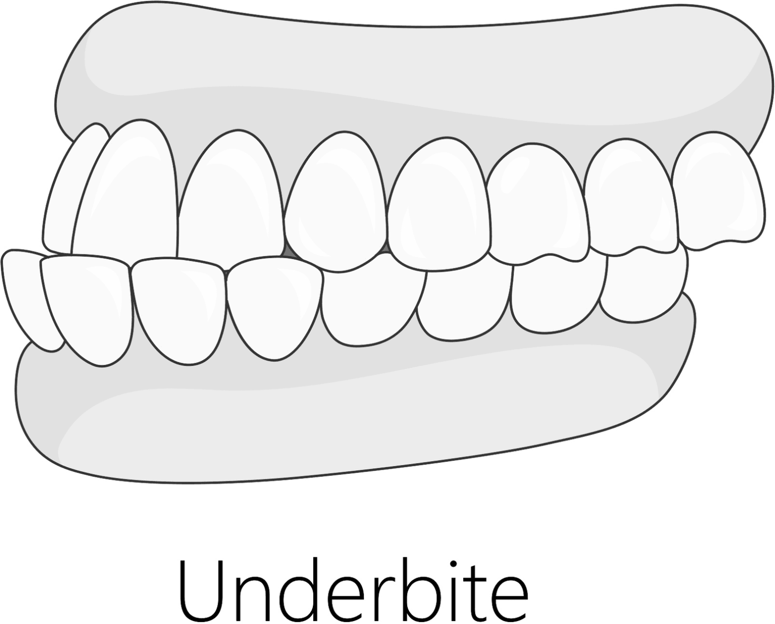 Adult Orthodontics: Smile with Confidence at Any Age | American ...