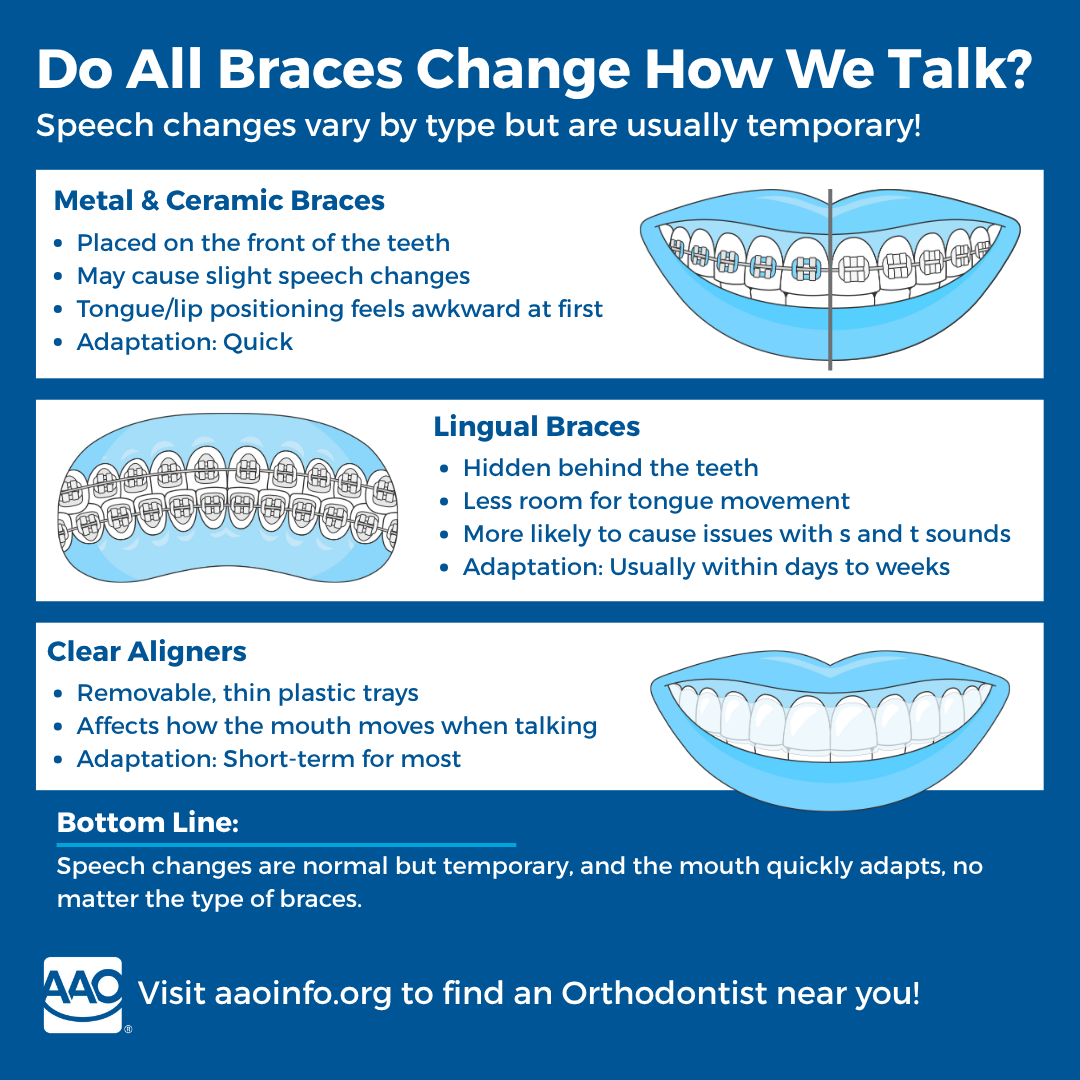 Do Braces Change How You Talk? | American Association of Orthodontists