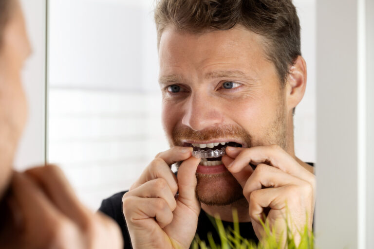 Clear Aligners: Discreet Ways to Straighten Teeth | AAO